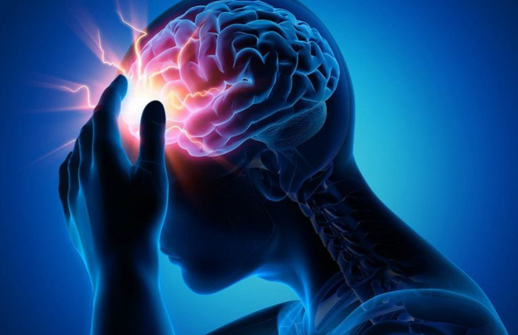 Acidente Vascular Cerebral (ACV) | Centro Médico H3Med