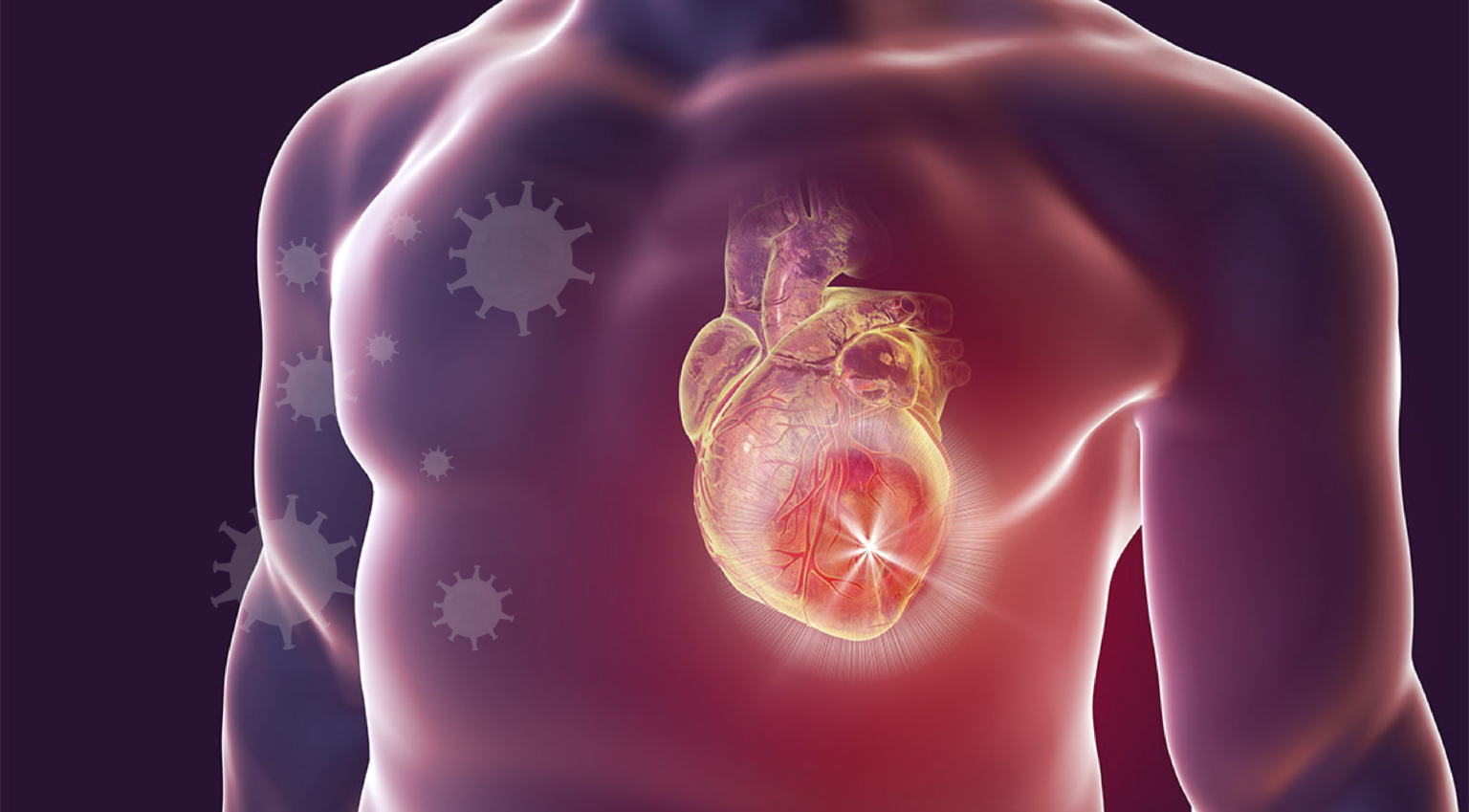 Miocardite | Centro Médico H3Med